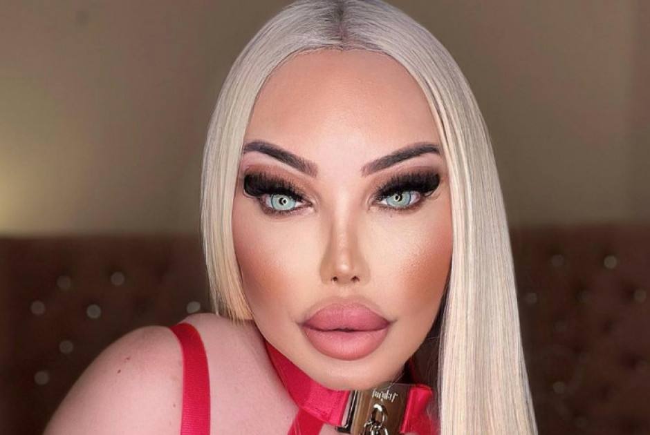 Η ανθρώπινη «Barbie» με τις 103 πλαστικές – Πλήρωσε 650.000 λίρες για ...