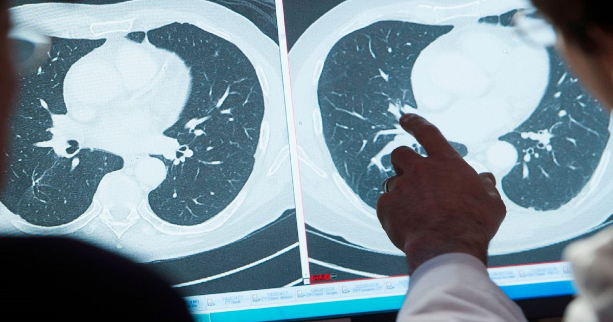 Δωρεάν εξετάσεις για έγκαιρη διάγνωση του καρκίνου του παχέος εντέρου ...