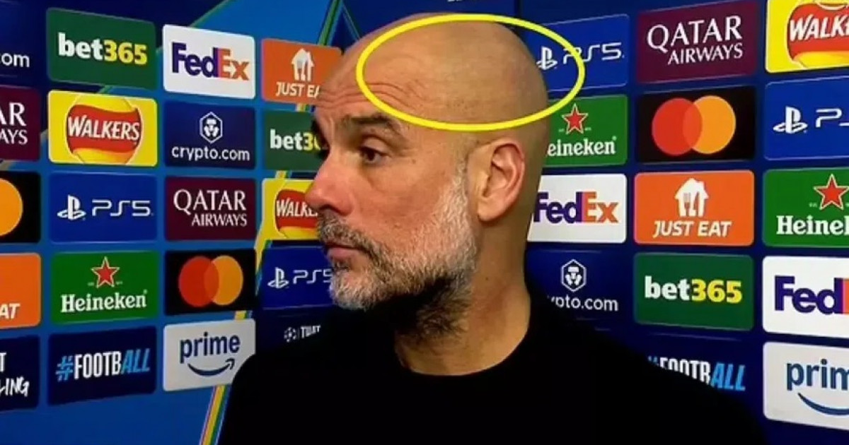 Το έκανε ξανά ο Πεπ; Εμφανίστηκε με γρατζουνιές στο πρόσωπό του μετά την ήττα από τη Ρεάλ ...